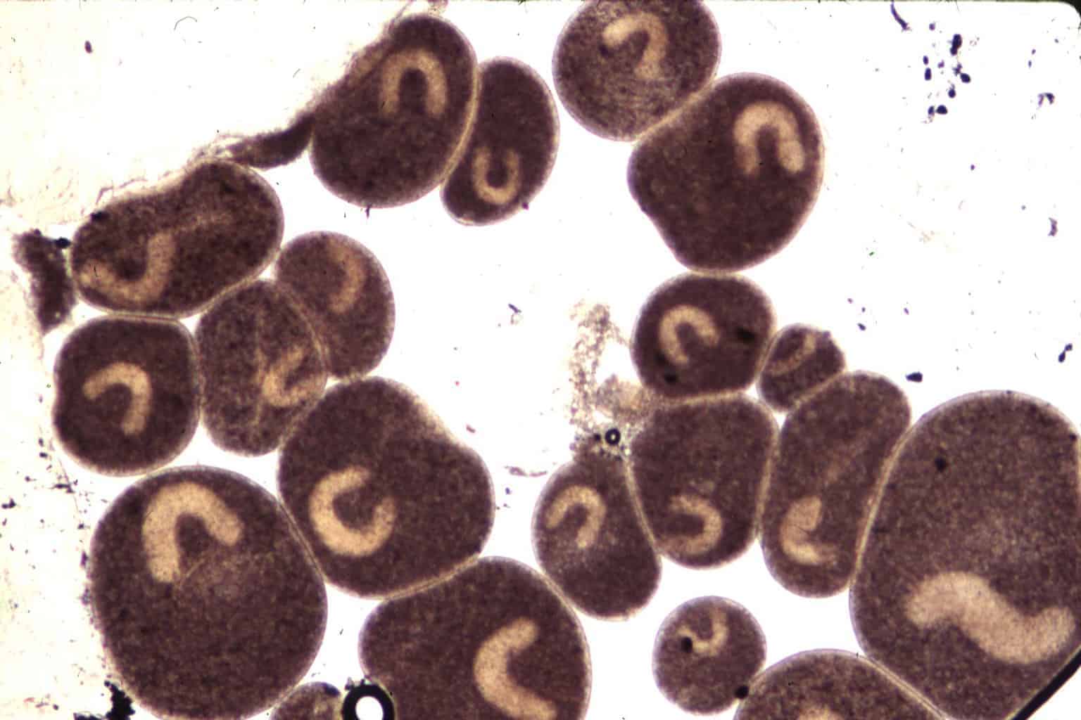How to Treat Ich 101: Diagnosis and Treatment Guide